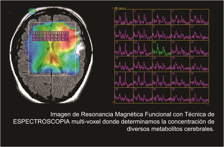 Resonancia1 - Reporte Ciencia UANL