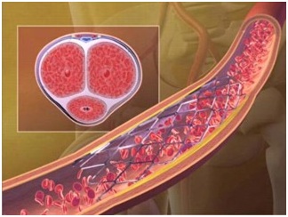 Nuevo Tratamiento para la Disfunción Eréctil - Reporte Ciencia UANL